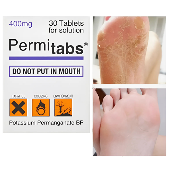 N-Potab Potassium Permanganate 30 BP Solution Tablets - Foot Care (Per ...